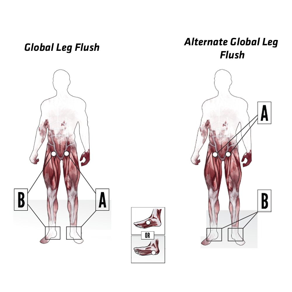 Marc Pro Use Tip: Alternate Global Leg Flush Set Up